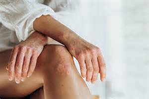 Facts Behind Different Types Of Autoimmune Diseases