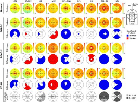 Thickness Maps Of The Outer Retinal Layer And Eight Intra Retinal