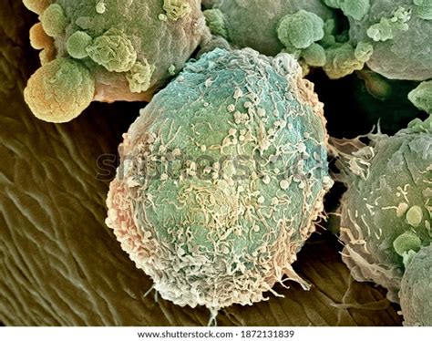 0 Lymphoma Lymph Cell Under Color Scanning Royalty Free Images Stock