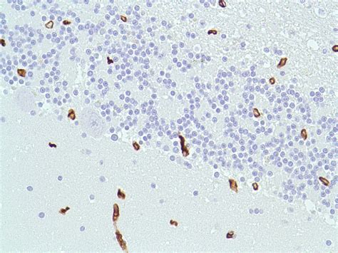 Endothelial Cell Marker 抗体组 Cd31 Cd34 Arg30300 Arigobio 中国