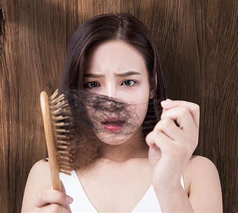 여성용 안티 필링 생강 샴푸 모발 고정용 가려움증 방지 오일 컨트롤 푹신한 모발 비이슬 개선 정품 브랜드 Aliexpress