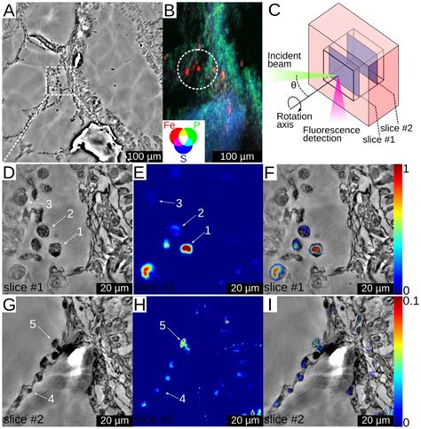 A Slice From A Low Resolution Electron Density Volume B Low