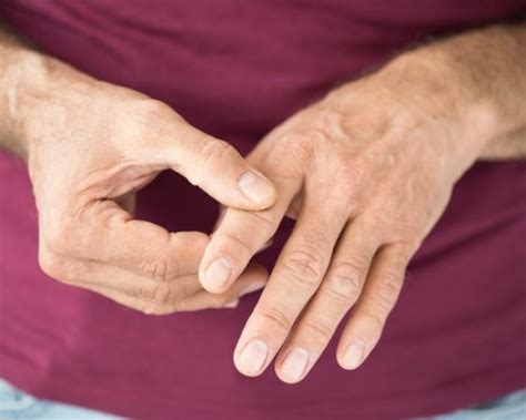 Erosive Inflammatory Osteoarthritis Symptoms Diagnosis And Treatment