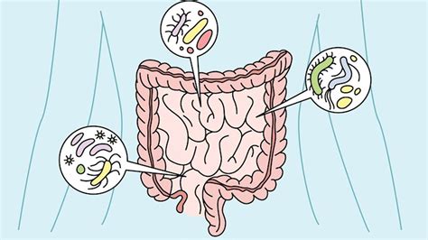 Amoebiasis Causes Symptoms Treatment And Prevention