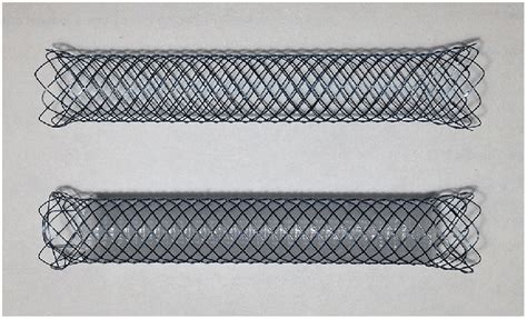 Wallflex Biliary Metallic Stents Wallflex Biliary Mss Upper Is The