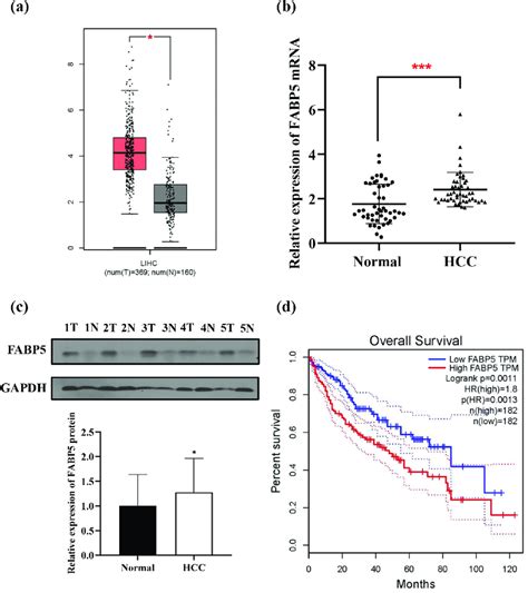 Fabp5 Expression Was Upregulated In Hcc A Expression Of Fabp5 In Hcc Download Scientific