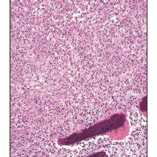 Morphologic Features Of The Original Dura Calvarium Lesion Ac H E Download Scientific