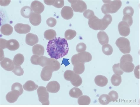 Basophils • The Blood Project