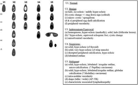 Ultrasound Grading Of Thyroid Nodules Using The Bta U Scoring Guidelines Is There Evidence Of
