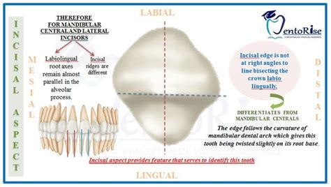 Permanent Mandibular Lateral Incisor Tooth Morphology Dental Anatomy Dental Anatomy