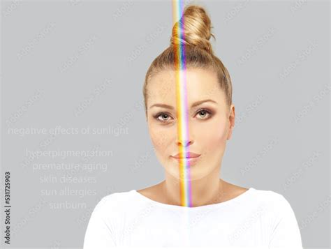 Negative Effects Of Sunlight Hyperpigmentation Premature Aging Sun