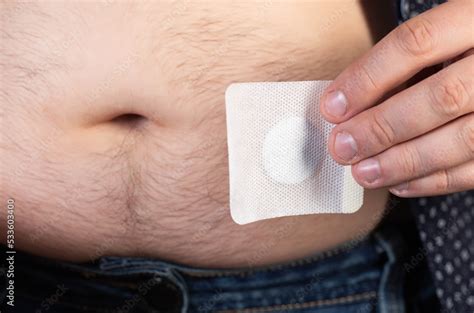 Foto De A Modern Medical Patch For Prostatitis And Urinary Tract