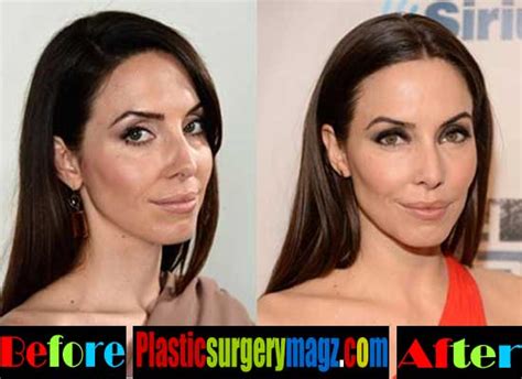 Whitney Cummings Plastic Surgery