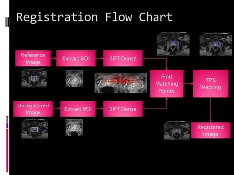 Post Processing Of Prostate Perfusion Mri Pptx Medical Tests Medical Health