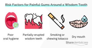 Swollen Gums Around Wisdom Tooth Guide To Pericoronitis Relief Share