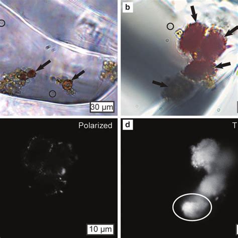 Photomicrographs Of Single Celled Algae And Carotenoids In Fluid