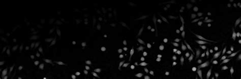 Quantifying Macrophage Activation With Livecyte
