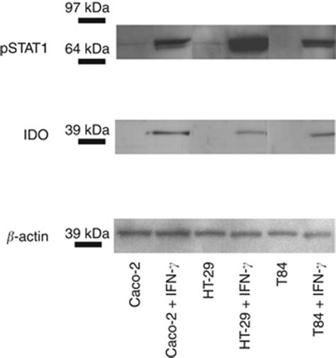 Western Blot Analysis Of Pstat1 And Ido1 Protein Expression In