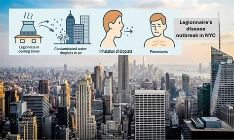 Legionnaire Disease Outbreak In New York City Healthylife Werindia
