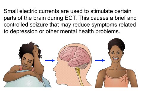Electroconvulsive Therapy Ect