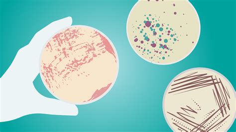 Infectious Diseases Diagnostics — Bio Rad