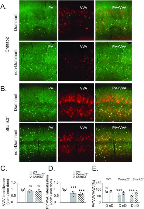 Expression Of Pv In Bc Interneurons In The Somatosensory Cortex Is Download Scientific Diagram