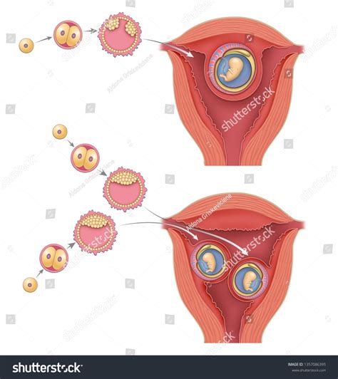 Human Embryo Twins