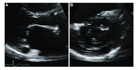 Transthoracic Echocardiography Download Scientific Diagram