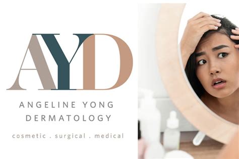 Angeline Yong Dermatology Hair Loss Treatment Clinic In Singapore