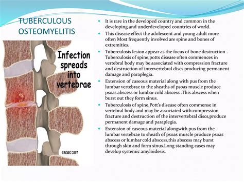 Osteomyelitis Pptx