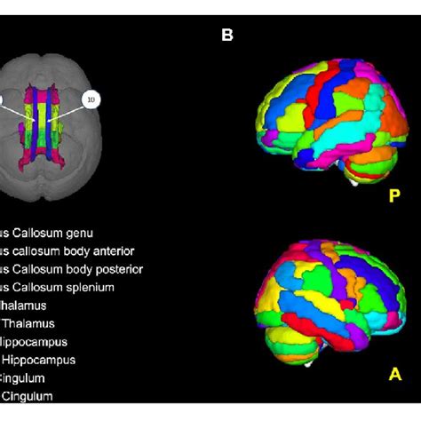A Brain Areas From Which Dti Features Fa Md Have Been Extracted