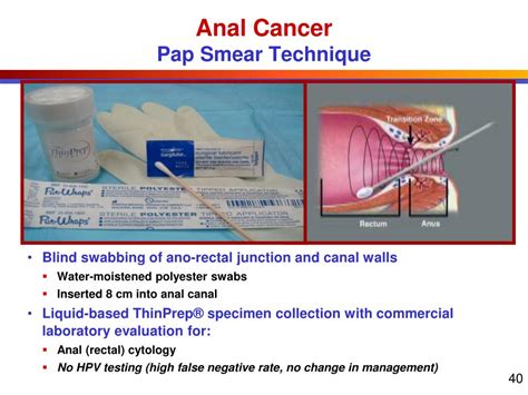Ppt Current Hiv Issues In The Us Long Term Non Aids Co Morbidities