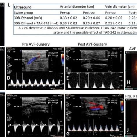 Ultrasound Angiography And Optical Coherence Tomography Angiography Download Scientific