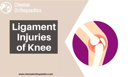 Ligament Injuries Of Knee Pdf