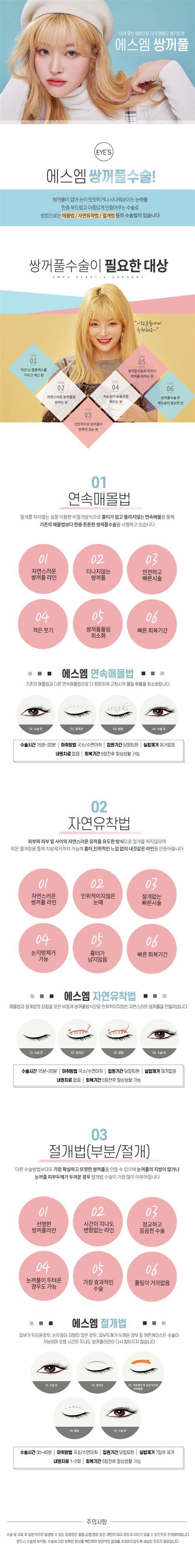 쌍꺼풀수술 에스엠 Sm 성형외과의원