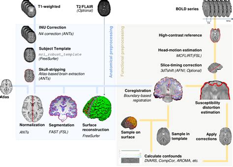 Fmriprep A Robust Preprocessing Pipeline For Functional Mri