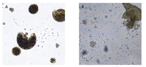 Spore Cysts A Spore Balls A And Ascospores B Reproductive Download Scientific Diagram