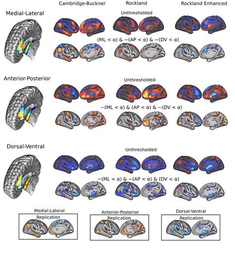Results Of First Analysis On Caudate Functional Connectivity Across 3