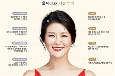 울쎄라·인모드리프팅·에어젯 비슷한 듯 다른 피부탄력레이저 라포르시안