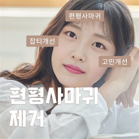 편평사마귀 얼굴전체 소멸패키지 할인 가격 후기 전후 효과 정보 By 당신만의가치벨유의원 여신티켓 국내 1등 피부과