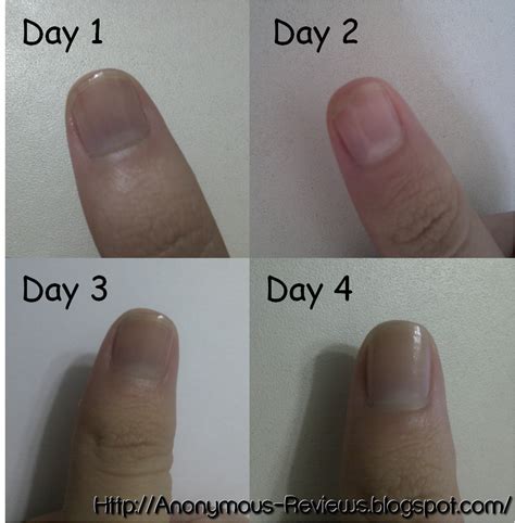 Sally Hansens Nail Miracle Growth Salon Strength Mystylebite