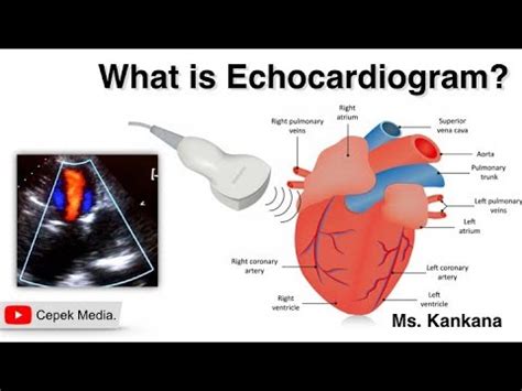 What Is Echocardiogram Biotechnology General Medicine Youtube
