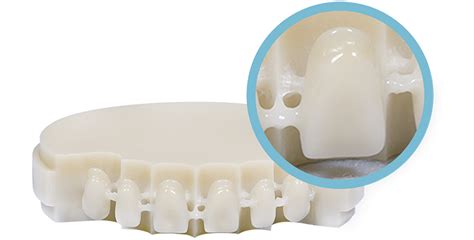 Multilayer Leonardodental