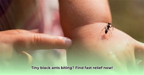 Do Tiny Black Ants Bite Fast Solutions And Prevention Chaztin