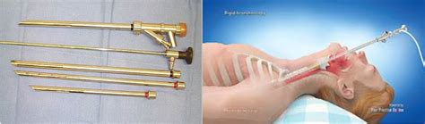 What Is Rigid Bronchoscopy Prof Dr Adalet Demir