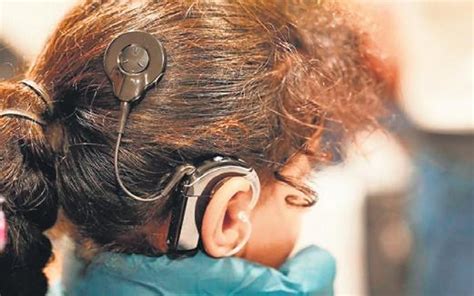 After Long Gap Kerala Govt Approves Funds To Upgrade Cochlear Implant