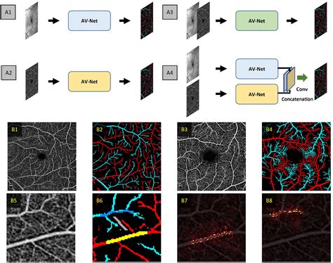 Figure 8 From Deep Learning For Arteryvein Classification In Optical Coherence Tomography
