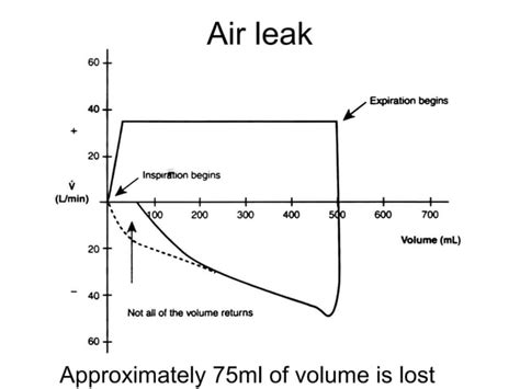 Interpretation Of Ventilator Graphics Ppt