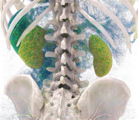 Healthy Abdominal Cavity Ct Angiogram Stock Image C0613532