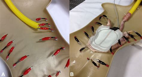 Development Of A Novel And Simple Ex Vivo Biologic Ercp Training Model